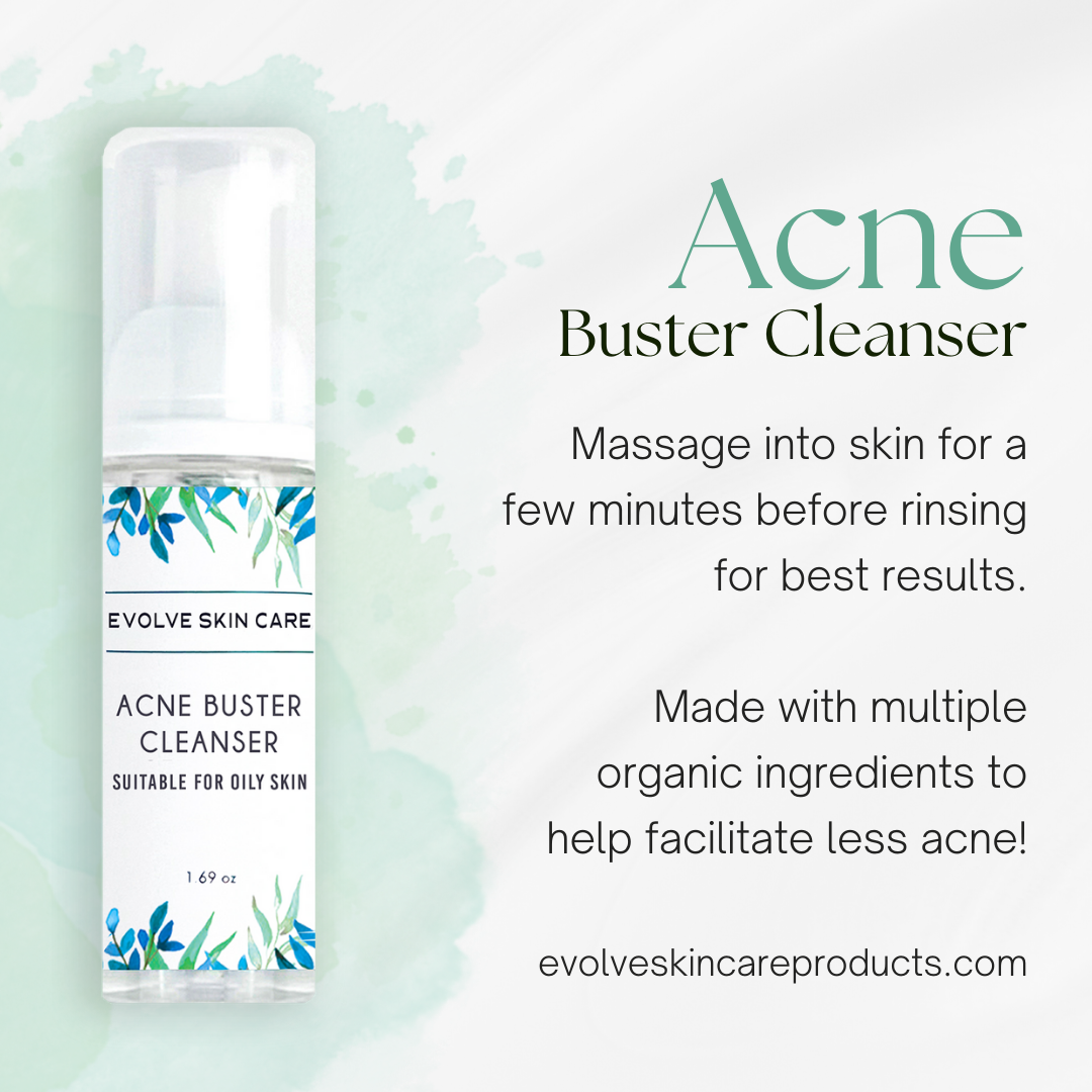 Evolve Skin Care Acne Buster Cleanser | Natural Ingredients | Quality ...